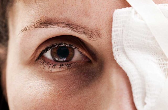 Eye Injury And Glaucoma: Questions And Answers - Glaucoma Research ...