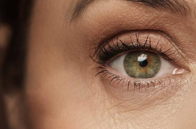 Glaucoma De Tensión Normal: Preguntas Y Respuestas - Glaucoma Research Foundation